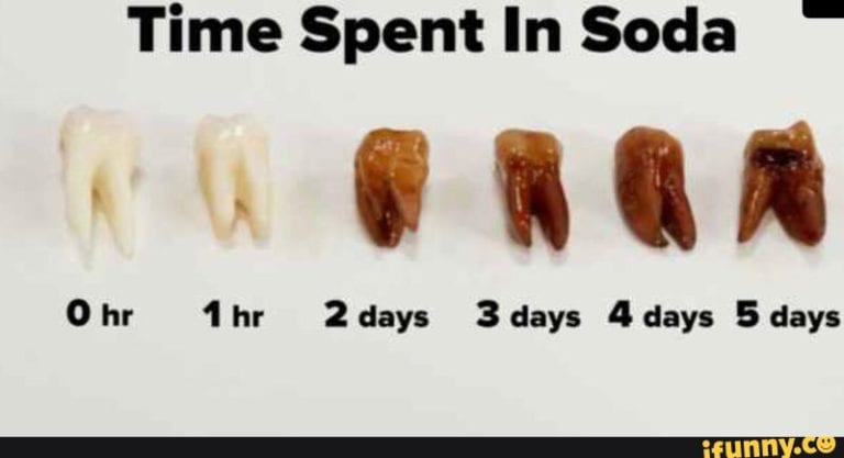 Sugary Drinks and How They Can Affect Your Teeth - Metro Dental Care